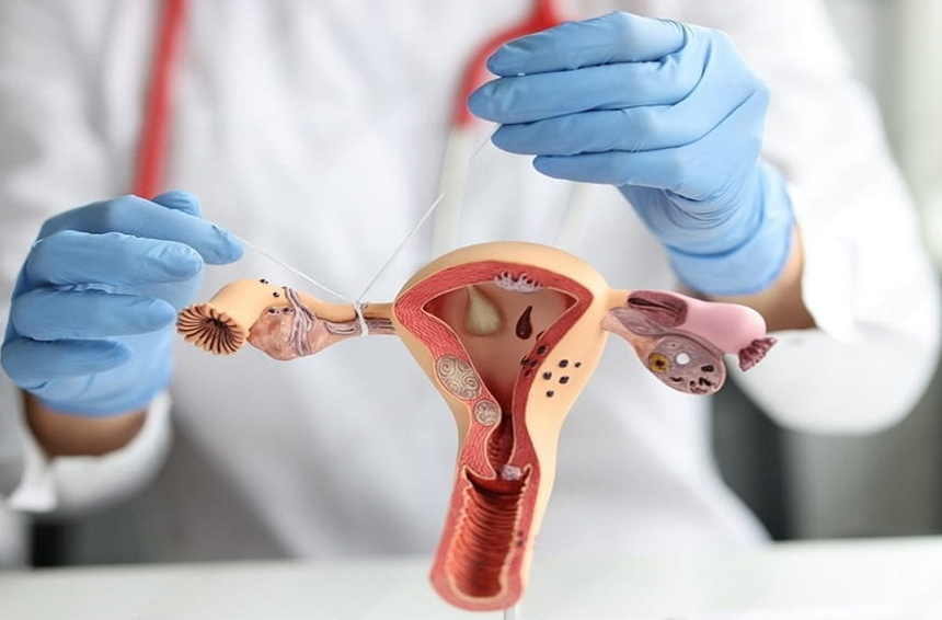 నిరోధించబడిన(బ్లాక్డ్) ఫెలోపియన్ ట్యూబ్‌లు: లక్షణాలు, కారణాలు, రోగ ...