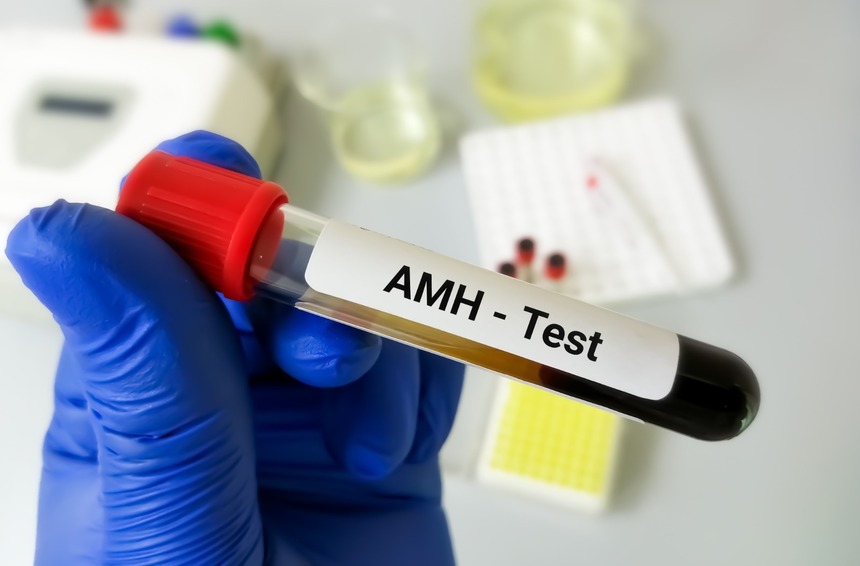What is an AMH Test? | Hegde Fertility